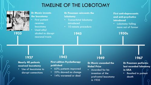 The history of lobotomy